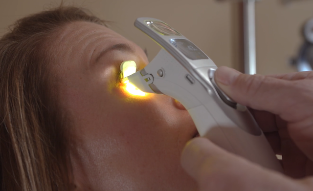 Systane iLux Treatment for MGD - Woodbridge Optometry